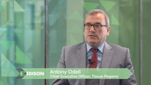 Executive Interview - Tissue Regenix - Edison Group