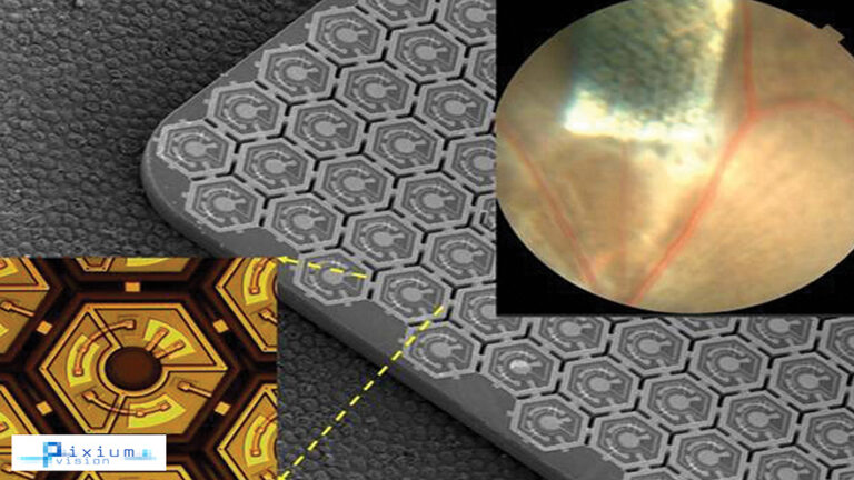 Pixium Vision - Edison Group
