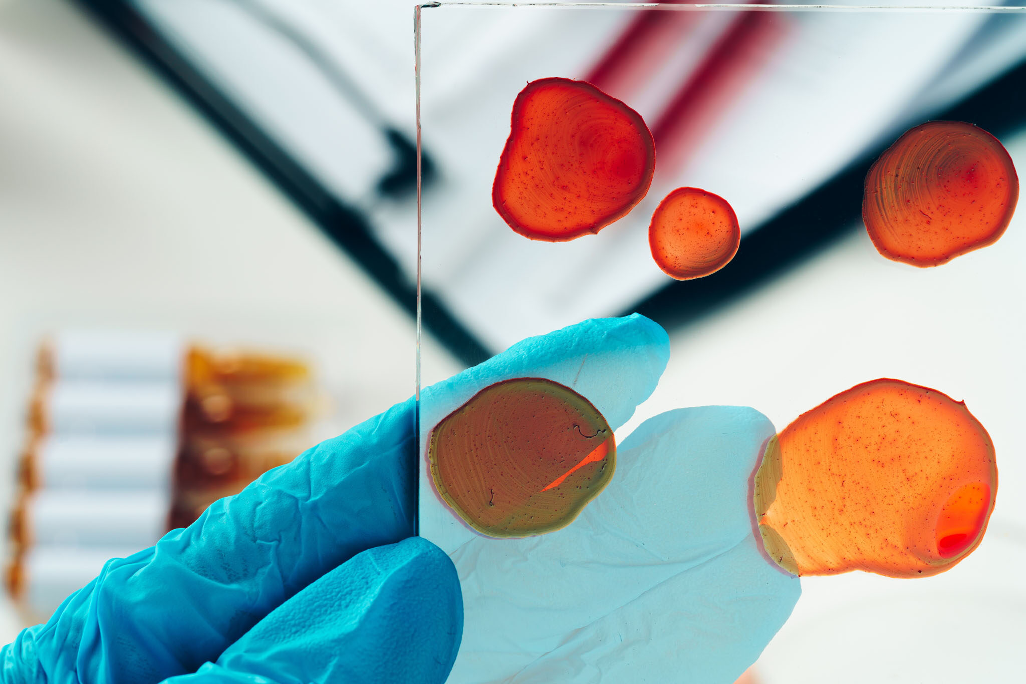 SIGA Technologies — US stockpiles front and center in Q1 and FY23 ...