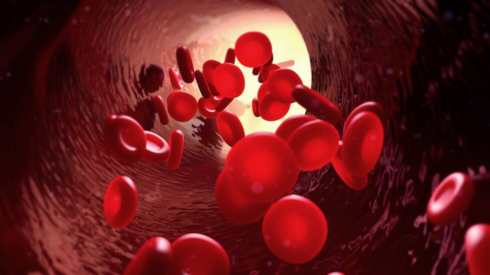 VolitionRx — Snaring sepsis, with early NETs detection - Edison Group